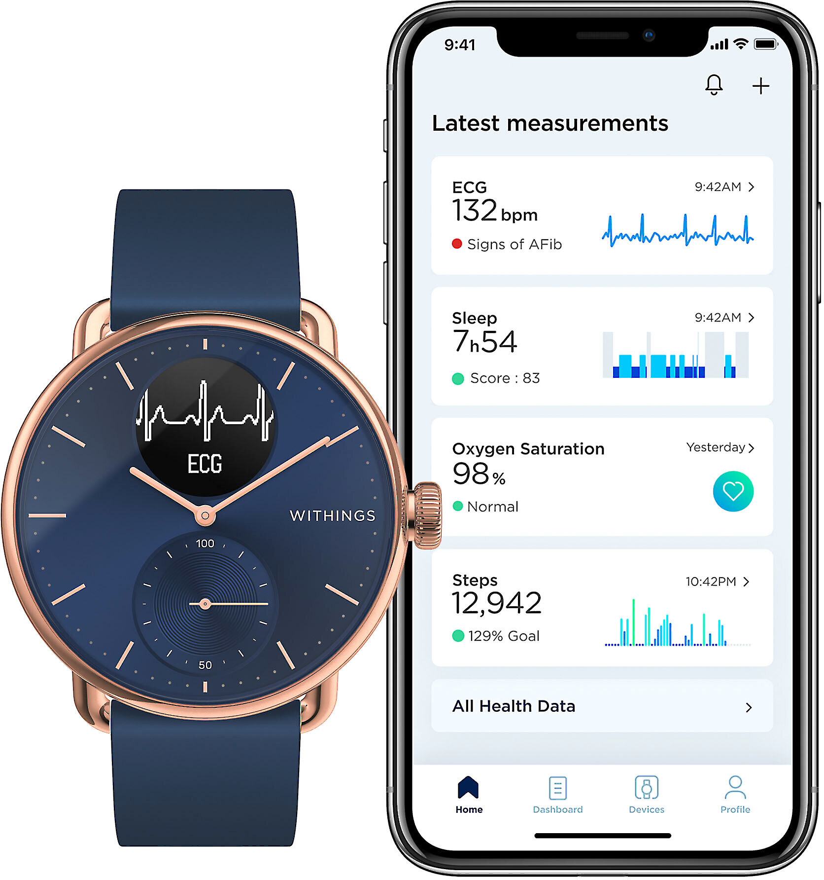 Customer Reviews: Withings ScanWatch (38 mm, Blue and Rose) Hybrid ...